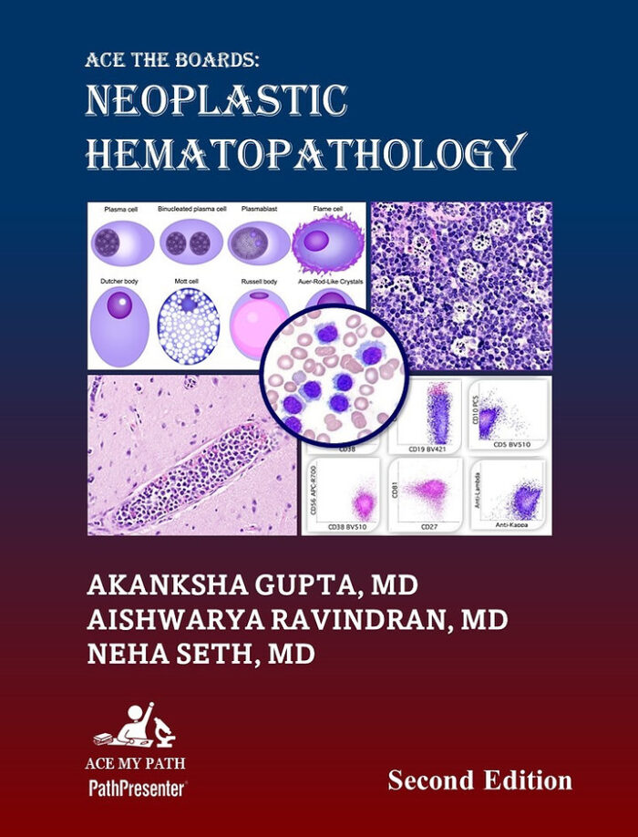 Ace The Boards: Neoplastic Hematopathology (Ace My Path), 2nd edition ...